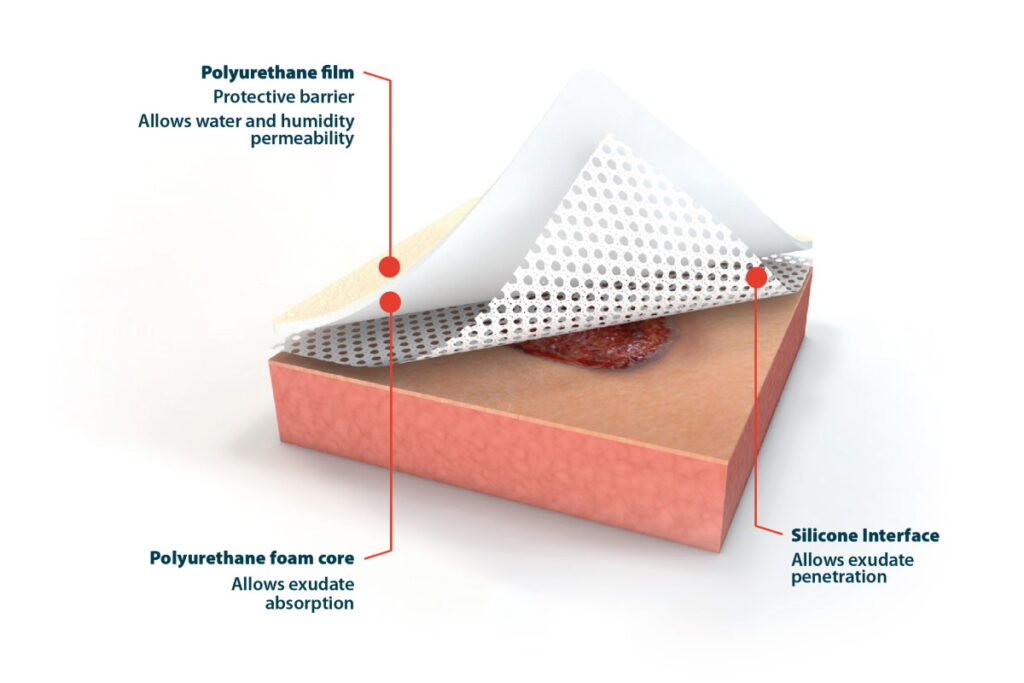 silfoam - ativcare.pro